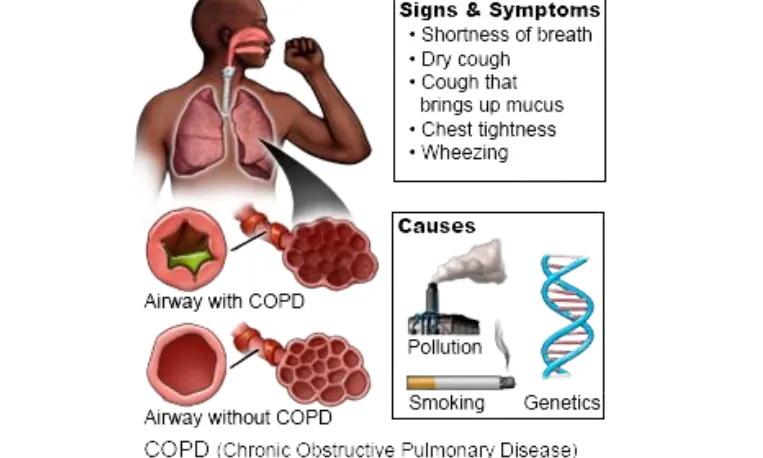 COPD Conditions: Symptoms, Causes & Prevention