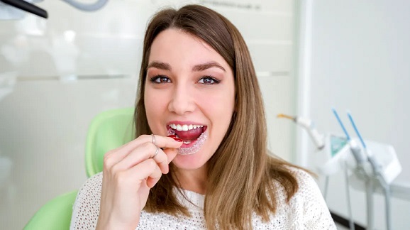 How Does the Invisalign Procedure Work?